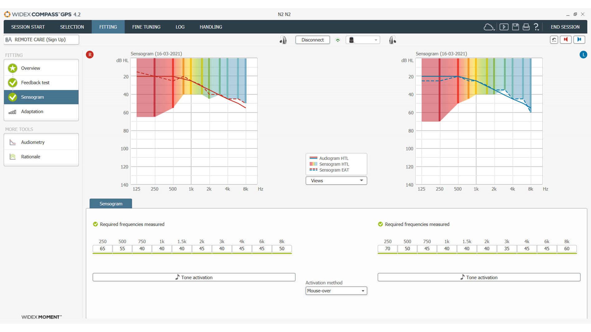 COMPASSフィッティングソフトウェア | Widex Pro